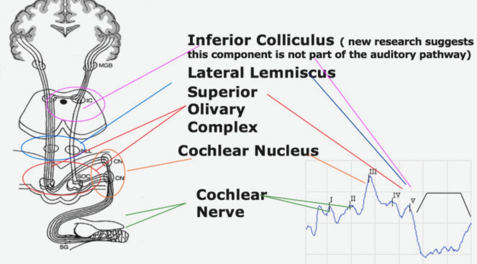 ABR Testing And How It Can Detect Hearing Loss