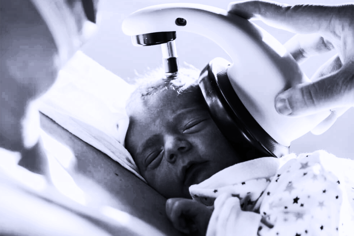 Auditory Brainstem Response (ABR)